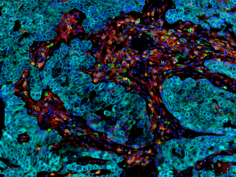 揭开多重 IHC 抗体组合设计的神秘面纱 揭开多重 IHC 抗体组合设计的神秘面纱